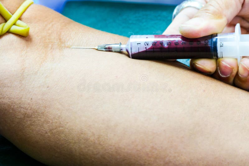 A blood test to check stock image. Image of check, detect - 79767087