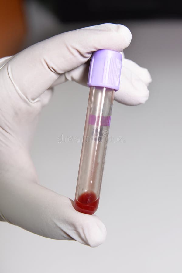 Blood Test Tube in a Laboratory Stock Photo - Image of chemical, health ...