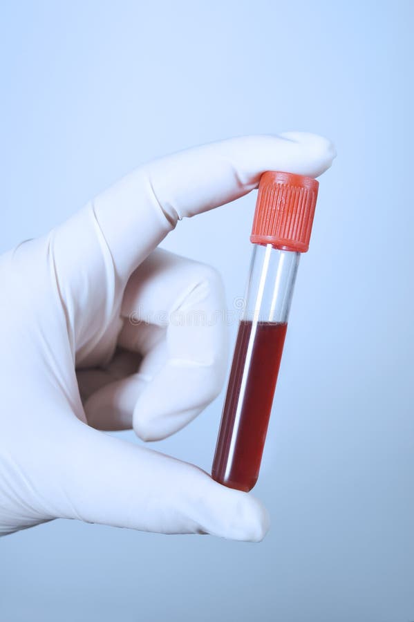 Blood Test Tube in a Laboratory Stock Photo - Image of research ...