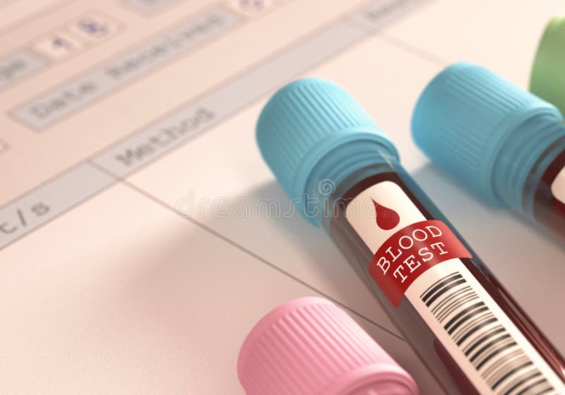 Blood Test stock image. Image of reactive, virus, antibody - 66863645