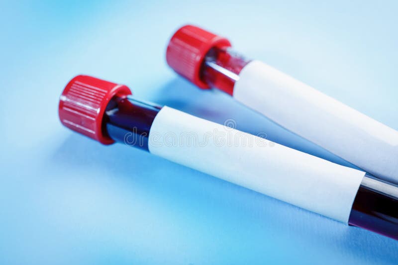 Blood in Test Tubes with Blank Labels on Light Blue Background, Closeup ...