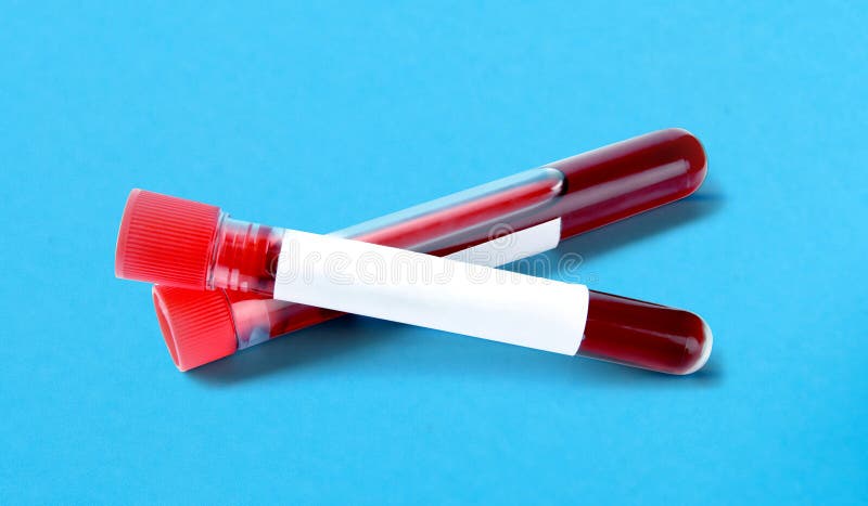 Blood in Test Tubes with Blank Labels on Light Blue Background. Medical ...
