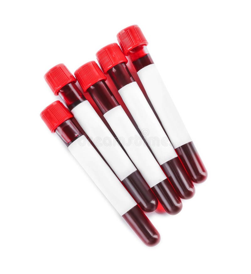 Blood in Test Tubes with Blank Labels on White Background. Medical ...