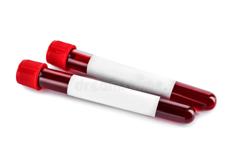 Blood in Test Tubes with Blank Labels on White Background. Medical ...