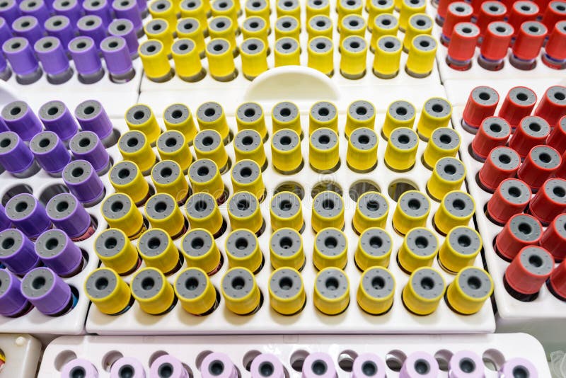 Blood Test Tubes in the Blood Collection Room. Stock Image - Image of ...