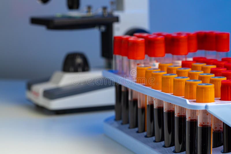 Blood Test Tubes in Lab Close Up Stock Photo - Image of chemical ...