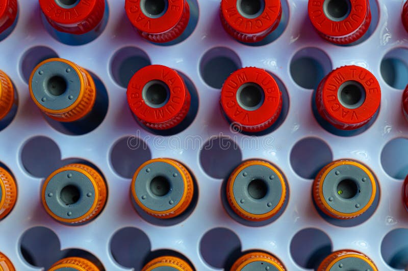 Blood Test Tubes in Lab Close Up Stock Image - Image of test, blood ...