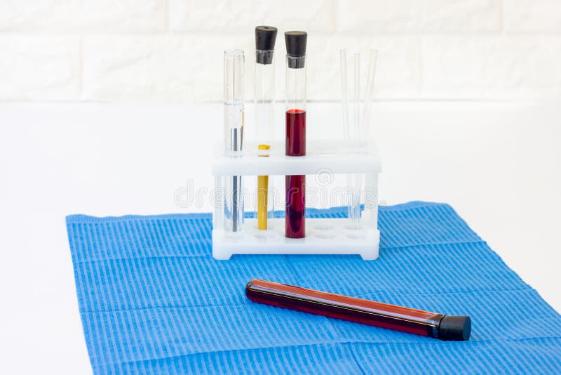 Blood in Test Tubes. Laboratory for Taking Blood Tests. Coronovirus ...