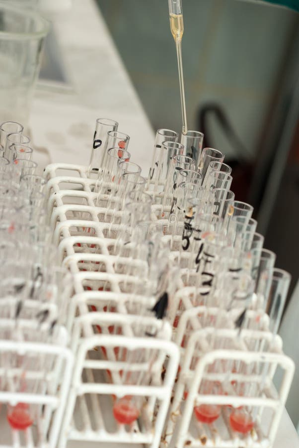 Blood in Test Tubes in Real Lab Stock Photo - Image of color, flask ...