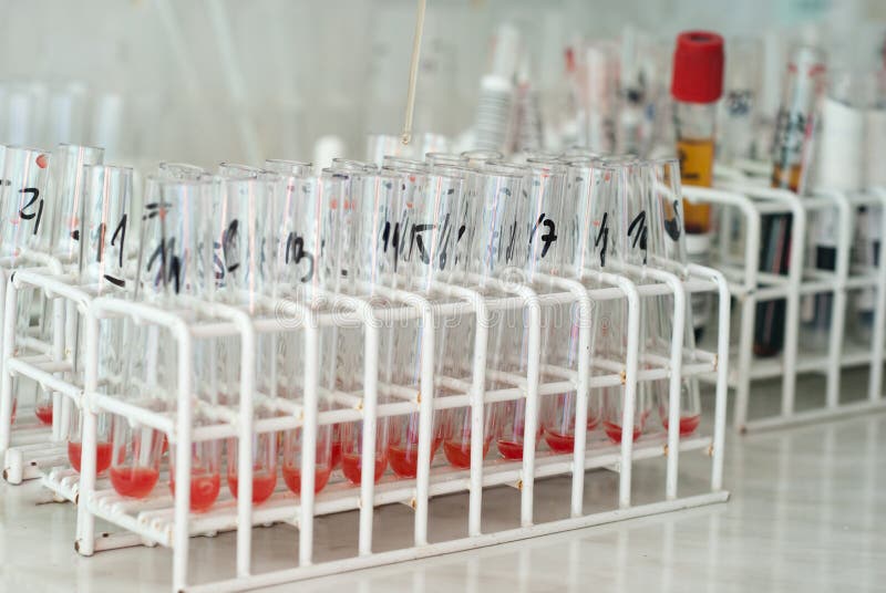 Blood in Test Tubes in Real Lab Stock Photo - Image of medical ...
