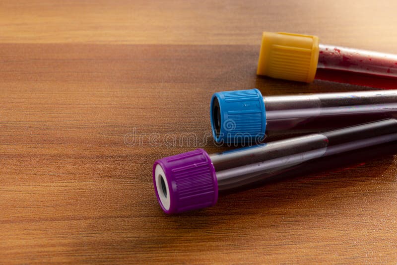 Blood Test Tubes on Wooden Table. Top View, Copy Space Stock Image ...