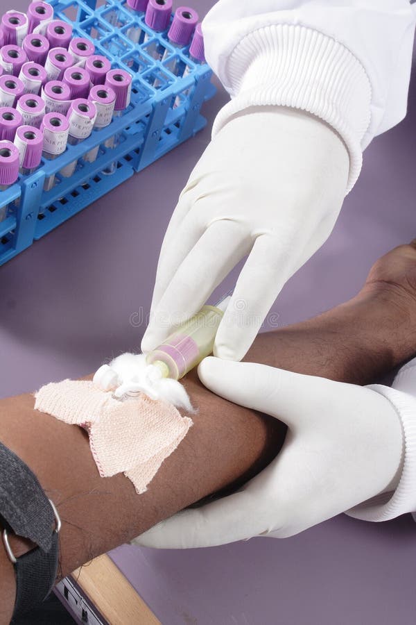 Blood testing lab stock photo. Image of beaker, gloves - 48552860