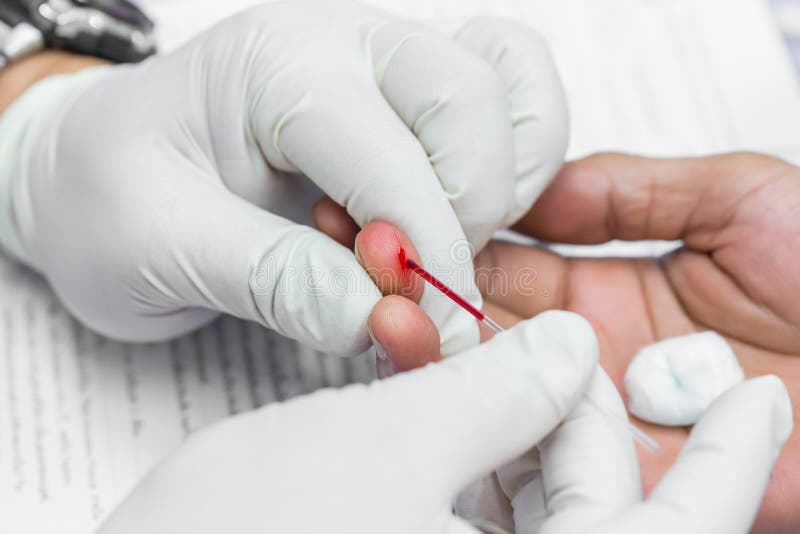 Blood testing stock image. Image of capillary, professional - 31338741
