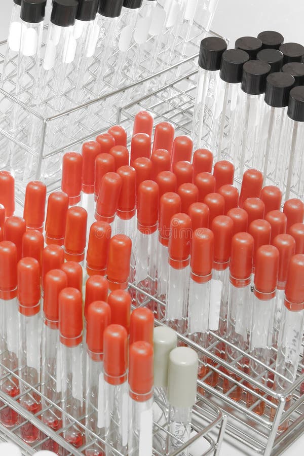 Blood Testing in Laboratory at Hospital Stock Photo - Image of analyze ...