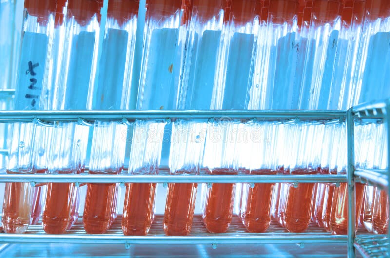 Blood Testing in Laboratory Stock Photo - Image of flask, biochemistry ...