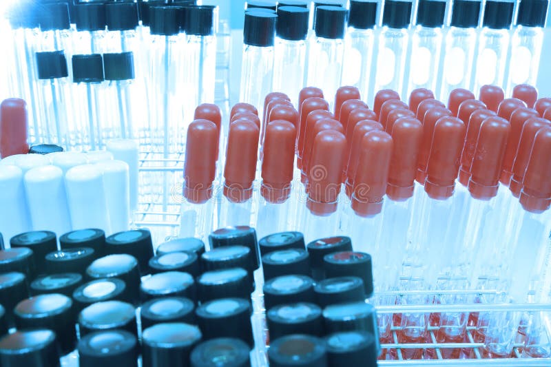 Blood Testing in Laboratory Stock Image - Image of experiment, chemist ...