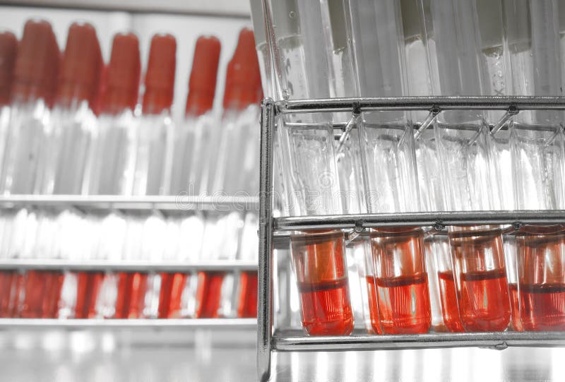 Blood Testing in Laboratory Stock Image - Image of measure, chemist ...