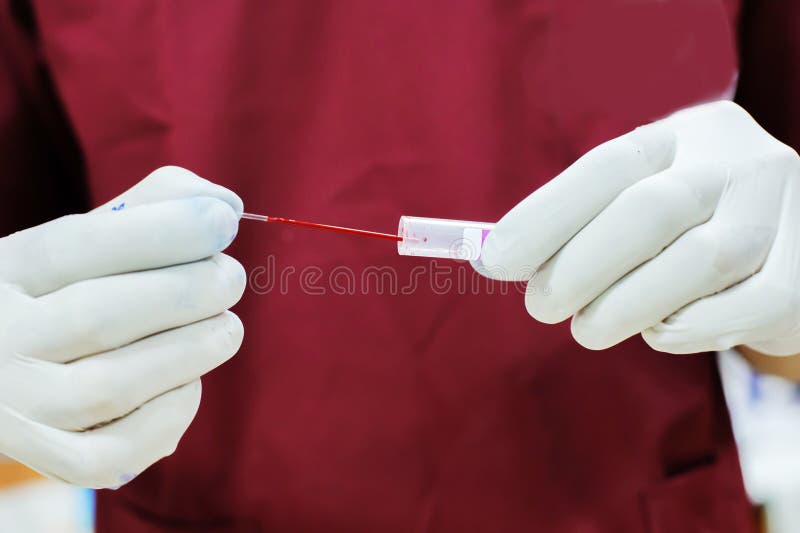 Blood Testing in Laboratory Stock Photo - Image of chemistry, education ...