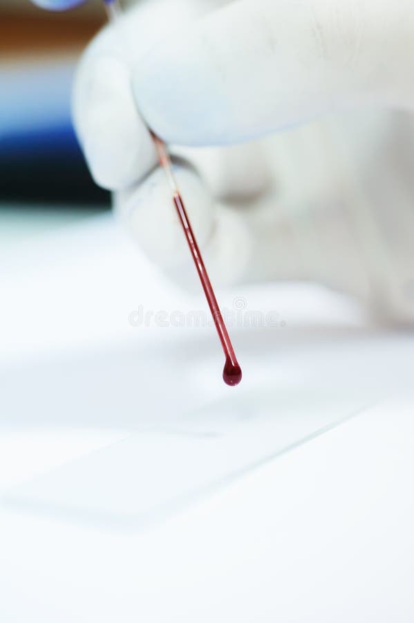 Blood Testing in Laboratory Stock Photo - Image of medicine, analysis ...