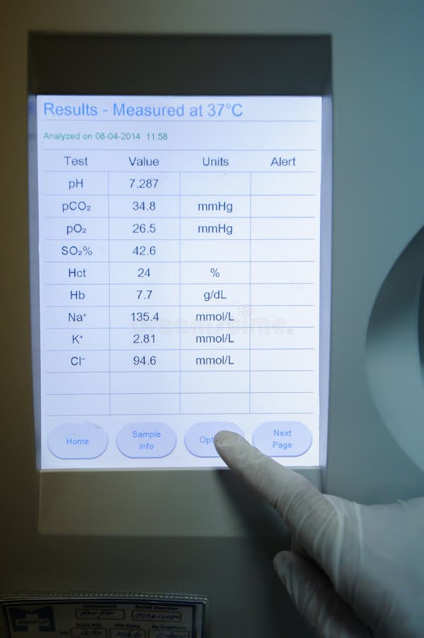 Blood Testing in Laboratory Stock Photo - Image of analysis, chemical ...