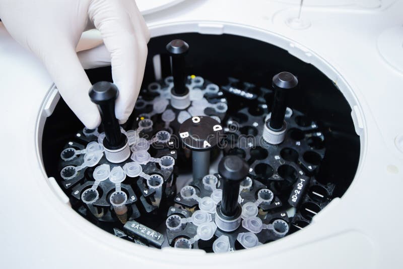 Blood Testing in Laboratory at Hospital Stock Photo - Image of analyze ...