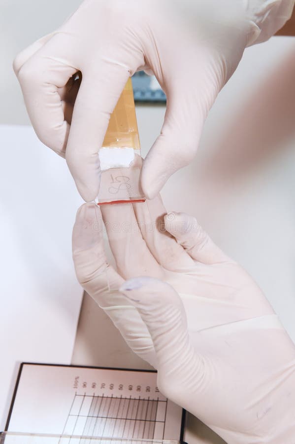 Blood Testing in Laboratory Stock Photo - Image of microbiology ...