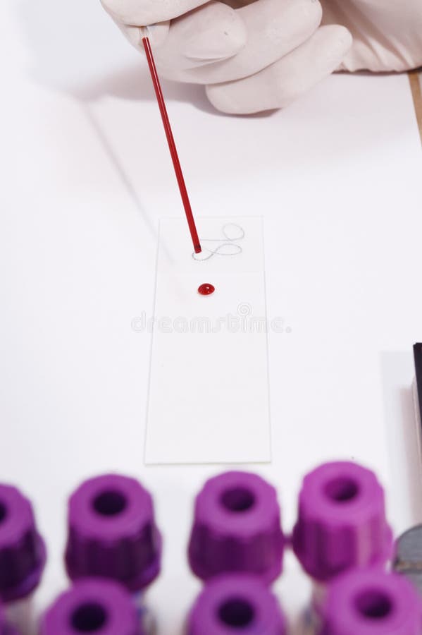 Blood Testing in Laboratory Stock Image - Image of chemist, biologist ...
