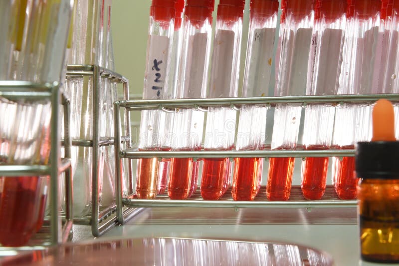 Blood Testing in Laboratory at Hospital Stock Photo - Image of analyze ...