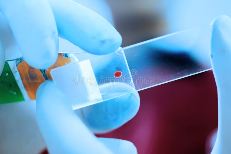Blood Testing in Laboratory for Microscope Stock Photo - Image of ...