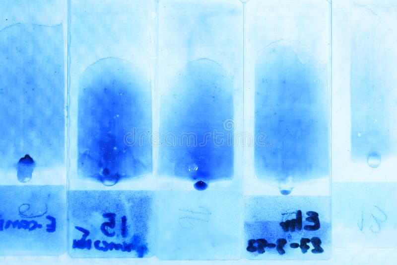 Blood Testing in Laboratory for Microscope Stock Image - Image of ...