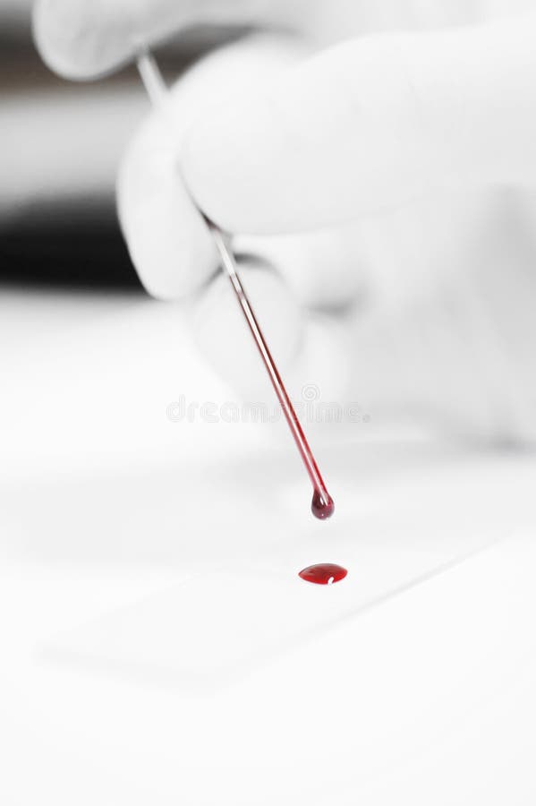 Blood Testing in Laboratory at Hospital Stock Photo - Image of analyze ...
