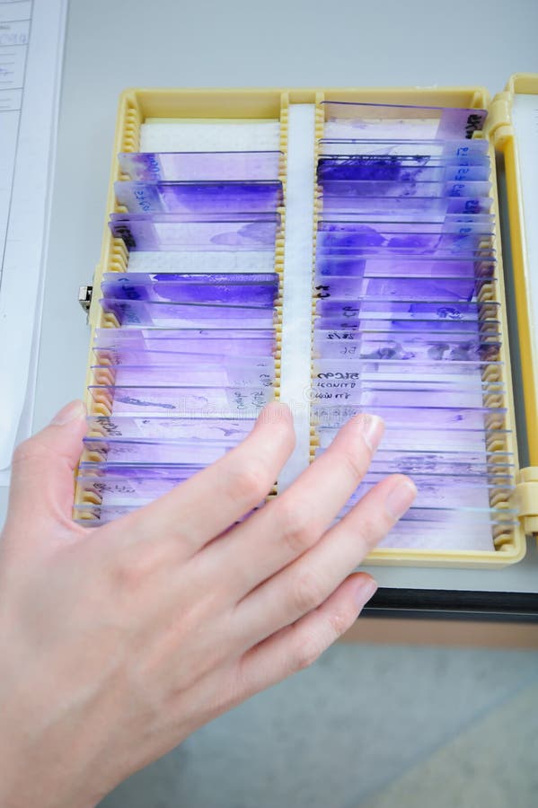 Blood Testing for Microscope Stock Image - Image of equipment ...