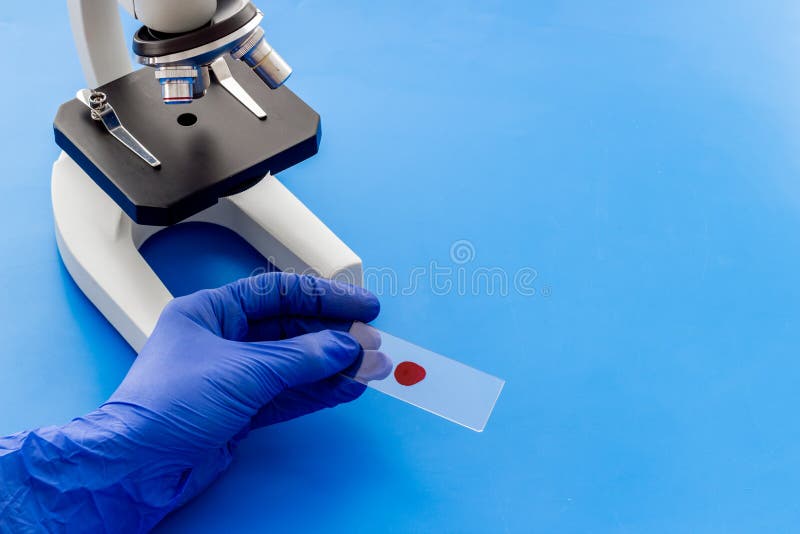 Blood Testing Laboratory. Samples Viewing Under Microscope Near Tubes ...
