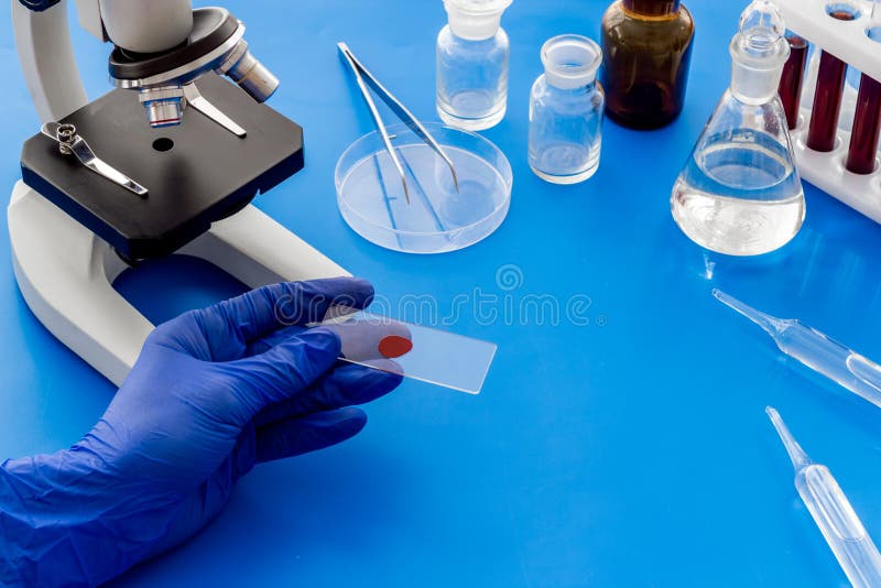 Blood Testing with Microscope in Laboratory. Sample in Hands on Blue ...