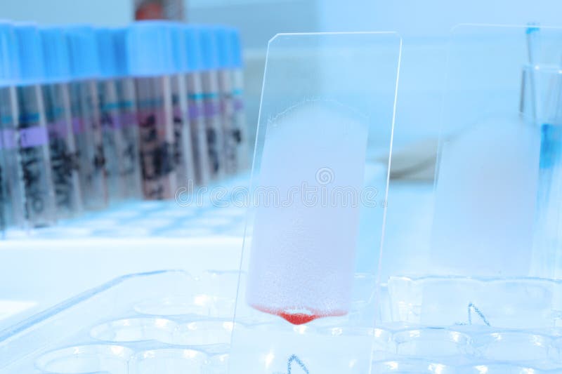 Blood Testing for Microscope Take with Blue Filter Stock Image - Image ...