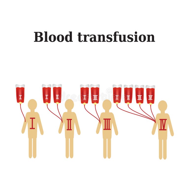 Blood Transfusion. Blood Groups. Infographics. Vector Illustration ...