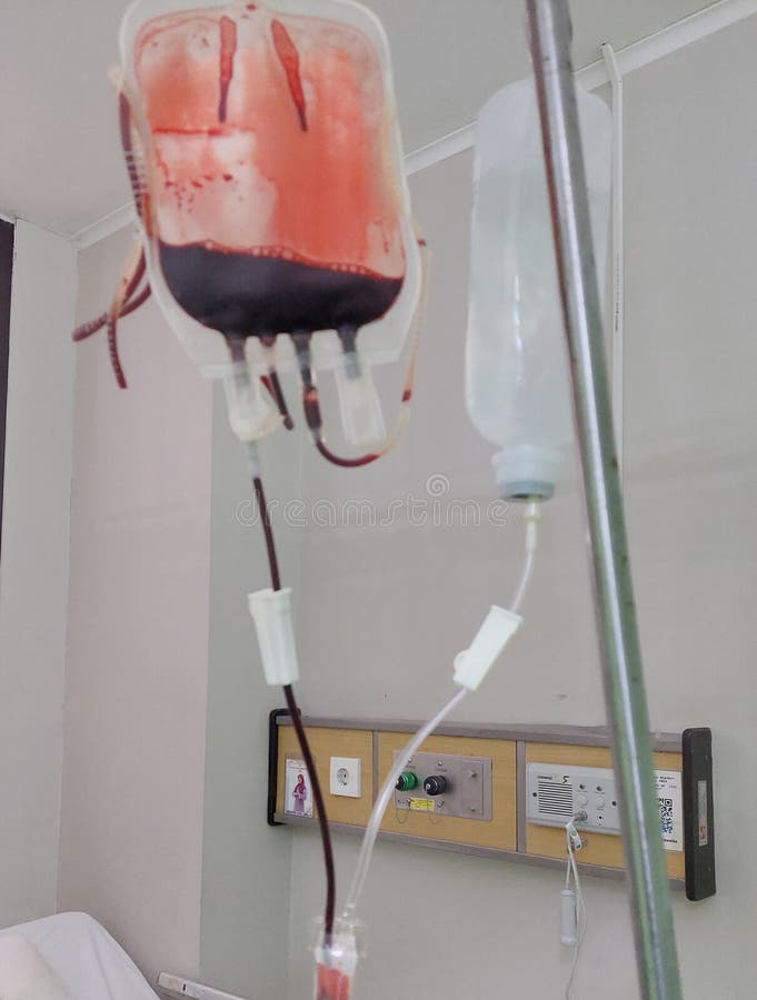 Blood Transfusion in Preparation for Surgery Stock Photo - Image of ...