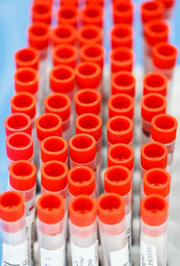 Blood tube stock photo. Image of syringe, medical, medicine - 80804376