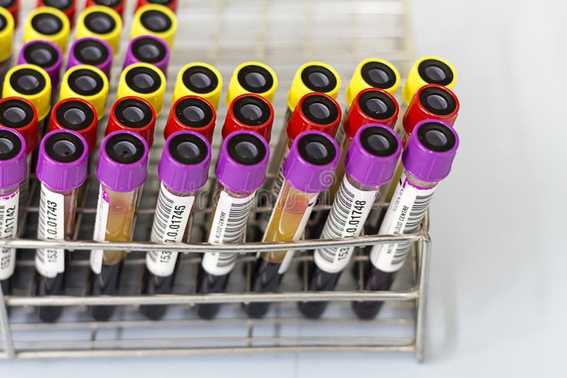 Blood in the Tube for Scientific Experimentation Stock Image - Image of ...