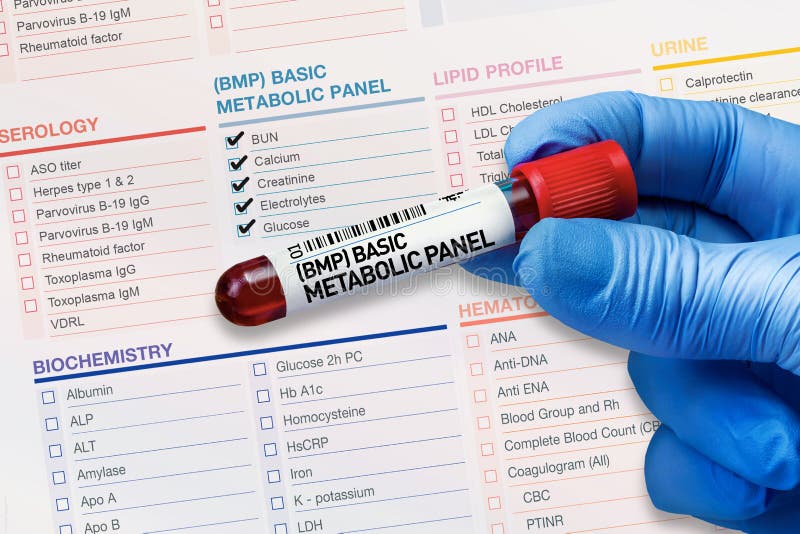 Blood Tube Test with Requisition Form for BMP Basic Metabolic Panel ...