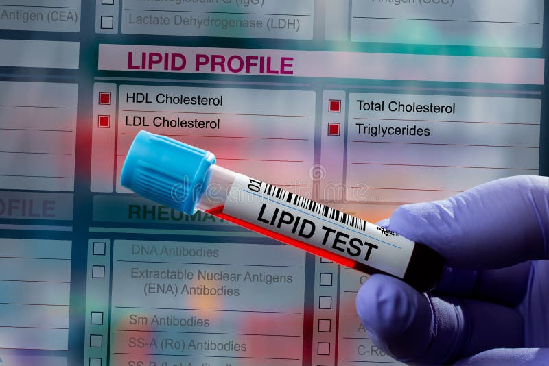 Blood Tube Test with Requisition Form for Lipid Test Stock Photo ...