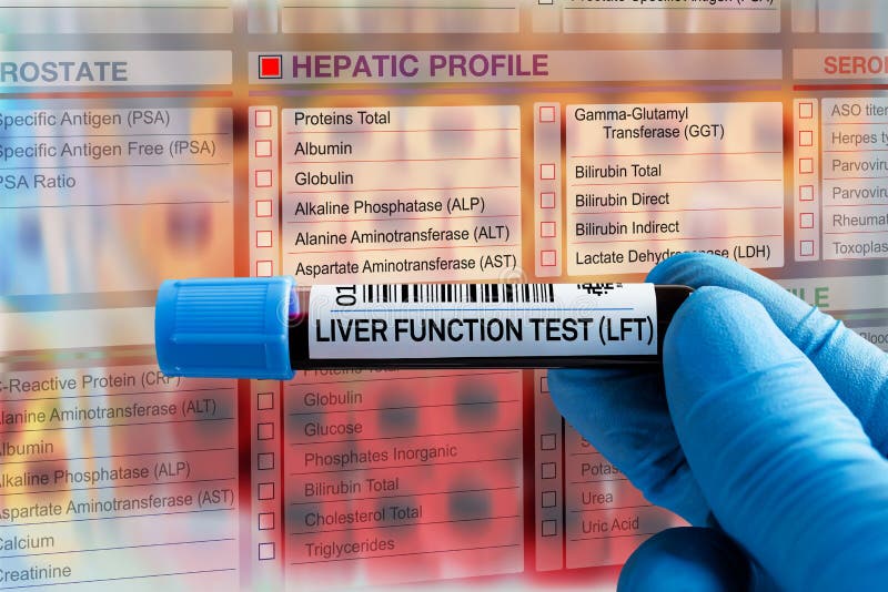 Lft Profile Stock Photos - Free & Royalty-Free Stock Photos from Dreamstime