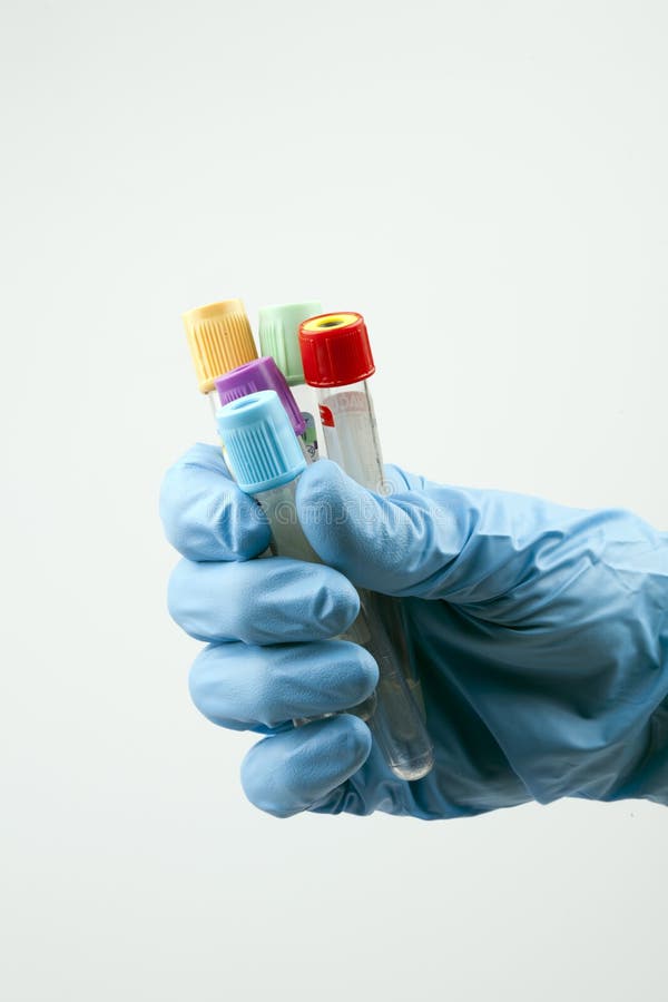Blood tubes stock photo. Image of medical, chemical, research - 74258