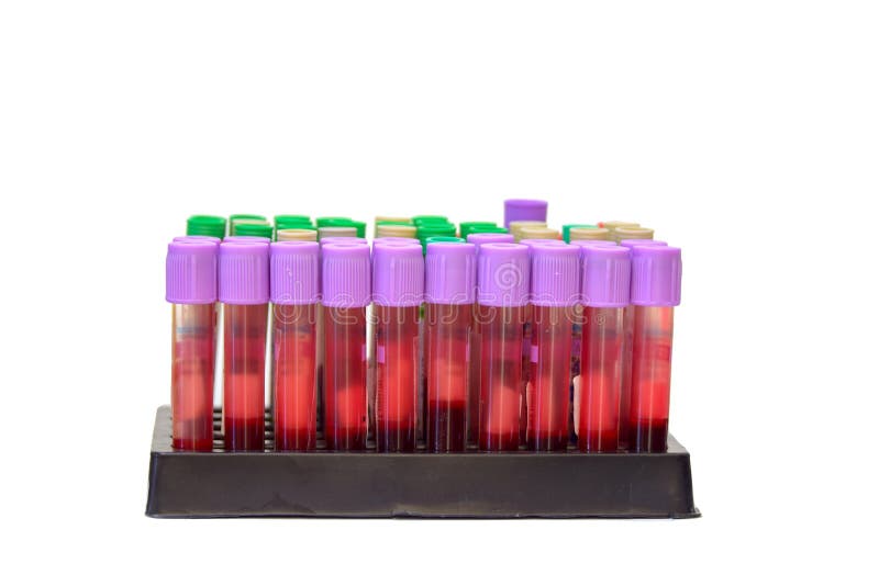 Blood Tubes , Blood in Tube for Laboratory Analysis Stock Image - Image ...
