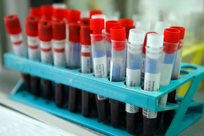 Blood Tubes in the Lab. Tests, Donation Stock Photo - Image of research ...