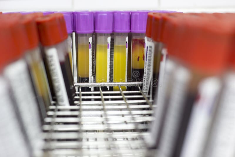 Blood tubes. stock image. Image of donate, hospital, sample - 38843461