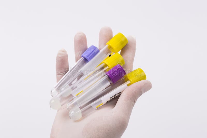 Blood Tubes White Background Stock Photo - Image of experiment ...