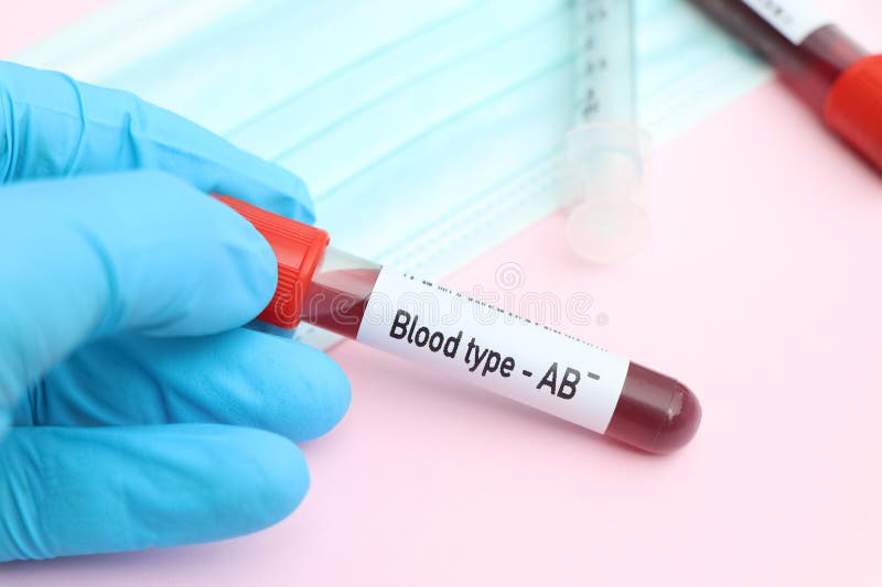 Blood Type AB Rh Negative Test, Blood Sample To Analyze in the ...