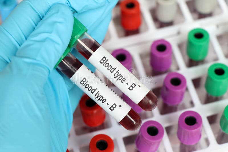 Blood Type B Rh Positive and Negative Test, Blood Sample To Analyze in ...
