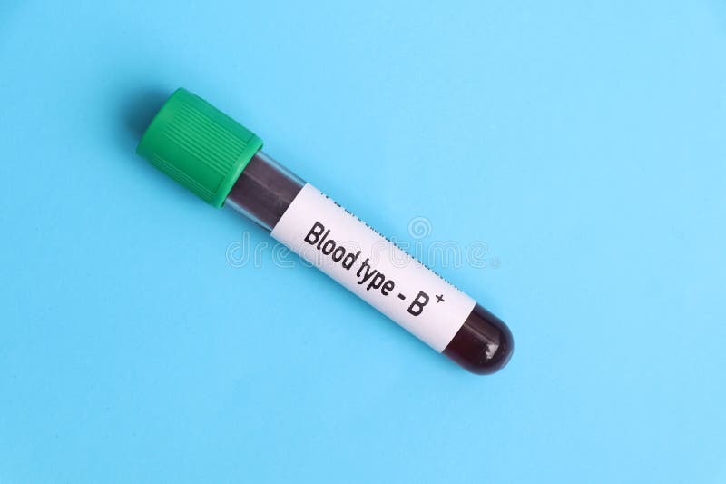 Blood Type B Rh Positive Test, Blood Sample To Analyze in the ...